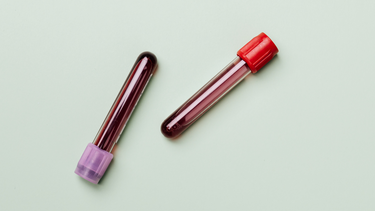 TTC and Fertility Test Glossary—What Each Test Means | Bird&Be